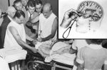 Before and After Lobotomy: Disturbing Pictures of Lives Changed Forever
