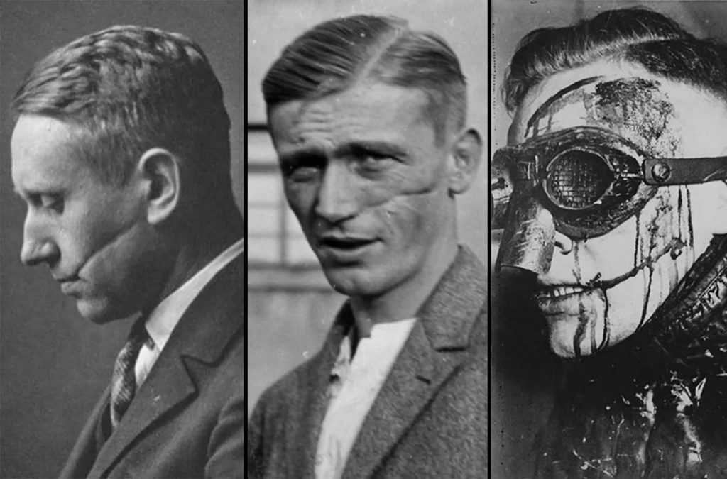 Mensur: Rare Photos of Germany’s Sword-Dueling Tradition Where Facial ...